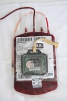 Medical Sensor Is Put On Blood Bags